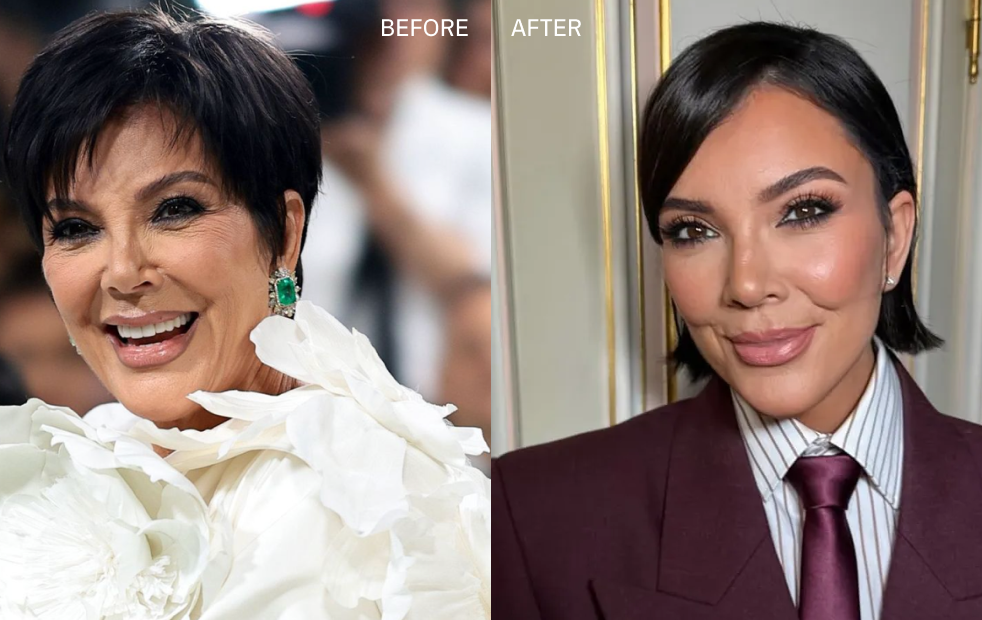 Kris Jenner Just Got a New Face - But This Is the Lift You Actually ...